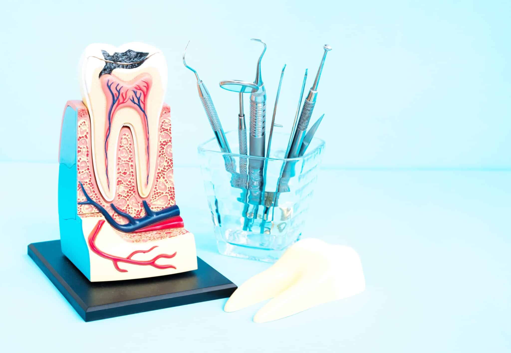 Ultimate Guide to Root Canal Rockford, IL Dentist: Dental Experts and ...